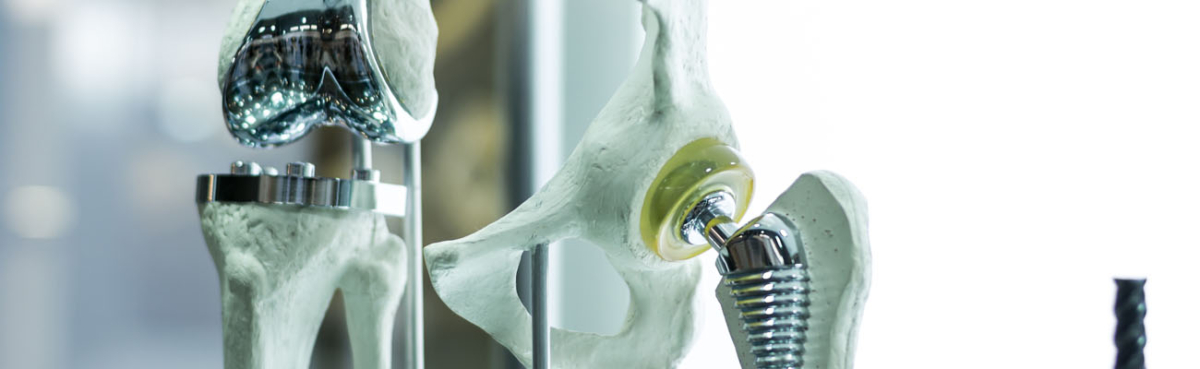 Artificial Joints - EconSight